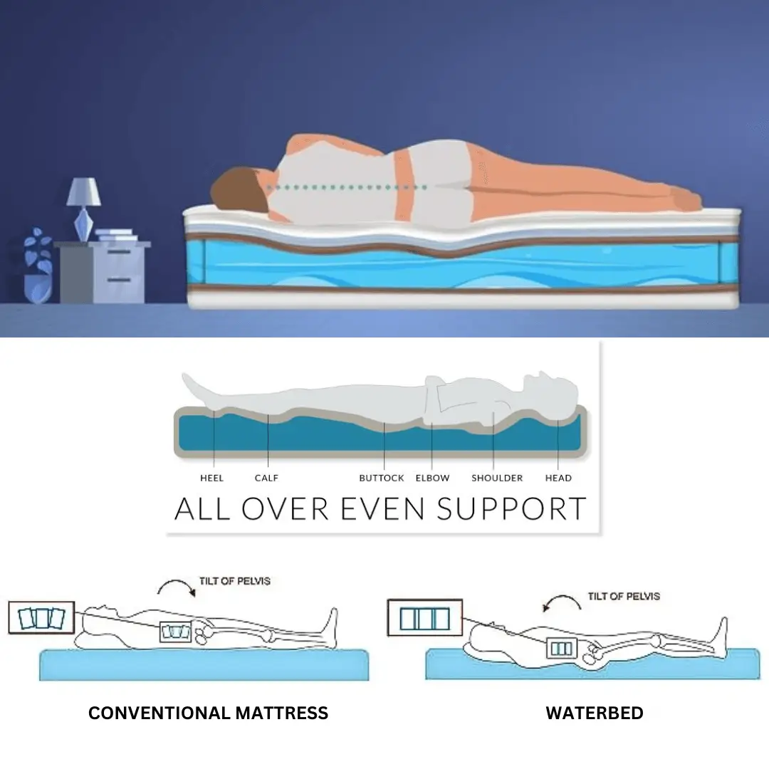 Unlocking the Therapeutic Benefits of Waterbeds for Rehabilitation and ...